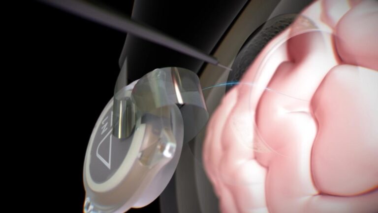 Neuralink, the company specialized in brain chips founded by Elon Musk ...